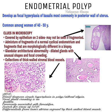 Biopsy Of Polyp On Uterus