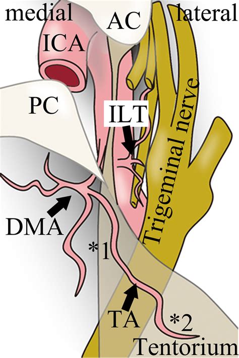 Schematic Depictions Of The Positional Relationship Of The Trigeminal Download Scientific