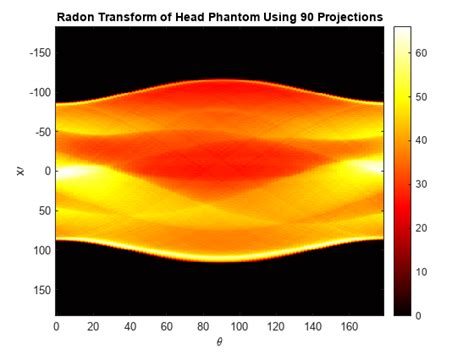The Inverse Radon Transformation Matlab And Simulink The Inverse Radon Transformation Matlab And Simulink