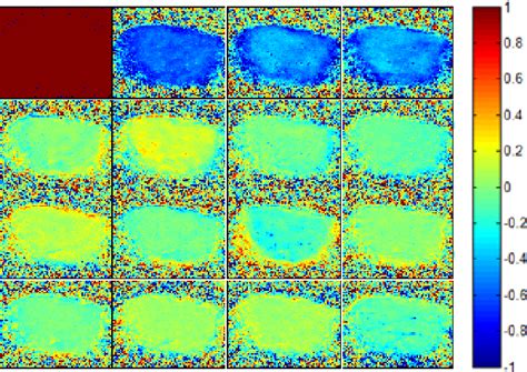 Figure 3 From Mueller Matrix Polarimetric Imaging Of Prostate Tissue Semantic Scholar