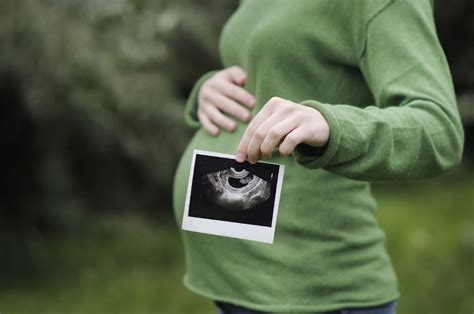 Fetal Morphology Assessment Fma Sonosif By Sifsof California
