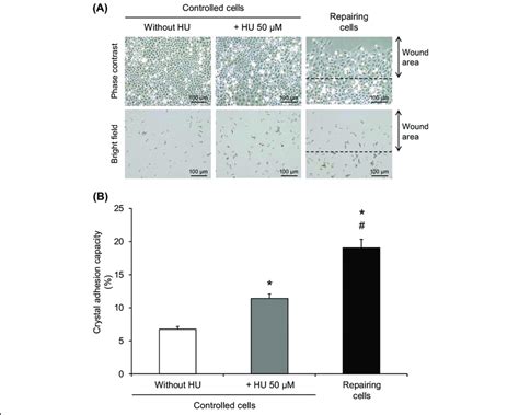 Enhanced Crystal Adhesion Capacity Of Hu Treated Cells A Com