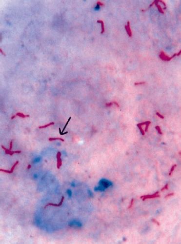 Micro Exam Flashcards Quizlet