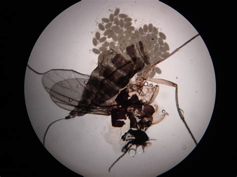 Fly Under Microscope