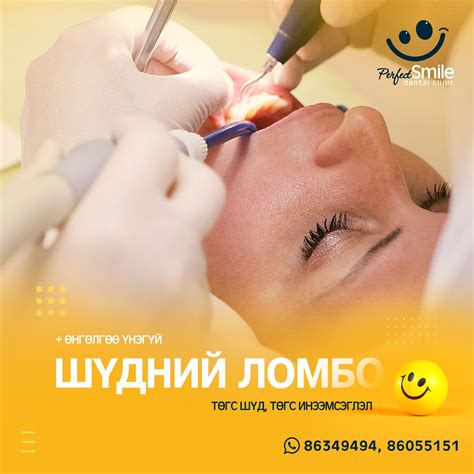 Perfect Smile Дээд доод 16 шүдэнд ШҮДНИЙ НҮҮРЭВЧ буюу ☆ Veneer хийсэний өмнөх дараах