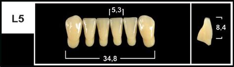 L5 B3 Lower Anterior Tribos Teeth Oraltec