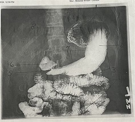 Pa Ugi Diagram Quizlet