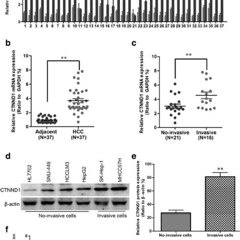 Ctnnd1 Is Highly Expressed In Hcc Tissues And Hcc Cell Lines A Ctnnd1