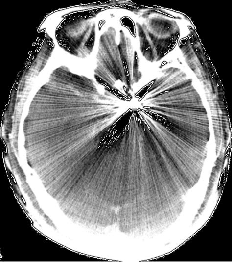 Image Interpolation Python Stack Overflow