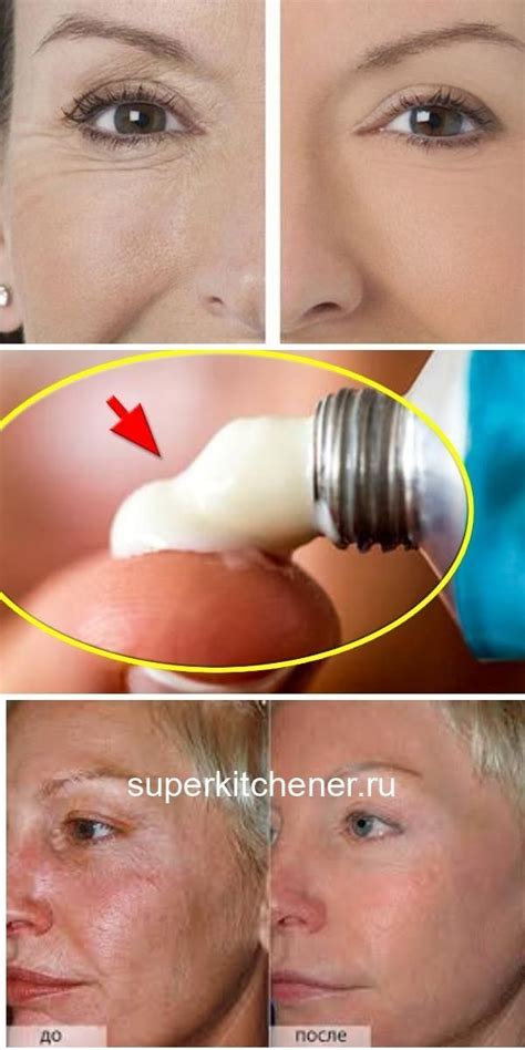 ВСЕГО 1 АПТЕЧНАЯ МАЗЬ И МОРЩИН БОЛЬШЕ НЕТ Источник Интересный контент в группе Что и