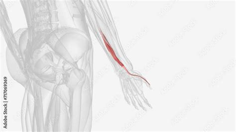 Extensor Pollicis Longus Is One Of The Deep Forearm Extensors That