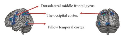 the cerebral cortex activation in patients with cis download scientific diagram