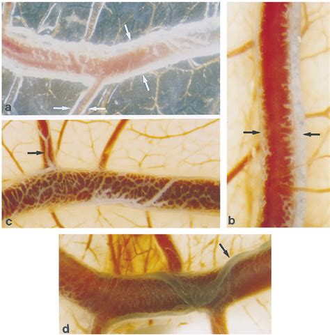 Lymphatic Plexus Semantic Scholar