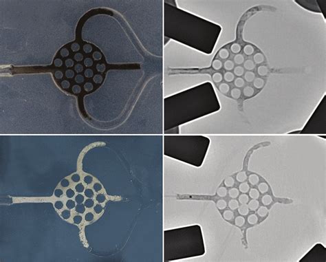 Photographs Of Onyx And Phil After Embolization With Fluoroscopic Download Scientific Diagram