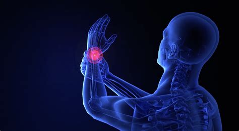 Bayesian Network Explained Ai And Ml Ultralytics