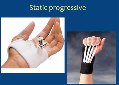 Mobilization Orthosis Flashcards Quizlet