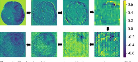 Figure 10 From Cascade Residual Multiscale Convolution And Mamba Structured Unet For Advanced