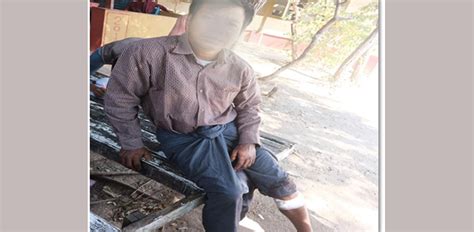 Pdf အမည်ခံအကြမ်းဖက်သမားများ ထောင်ထားသည့် လက်လုပ်မိုင်းပေါက်ကွဲမှုကြောင့် ၁၁ နှစ်အရွယ်ကလေးငယ် ၁