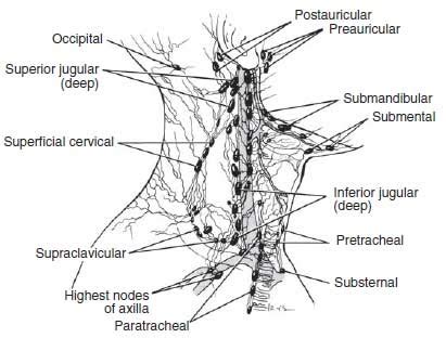 Metastatic Scalene Node Case File