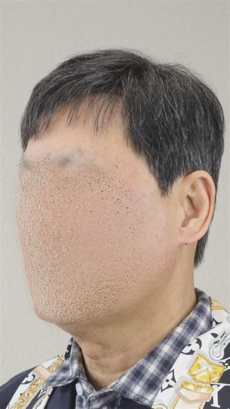 대구가발 남자가발 맞춤가발 부분가발 당일착용 가발대여 깔끔하고 자연스러운 위풍당당의 가르마스타일 👍 남자가발 맞춤가발 부분가발 대구가발 경산가발 경주가발