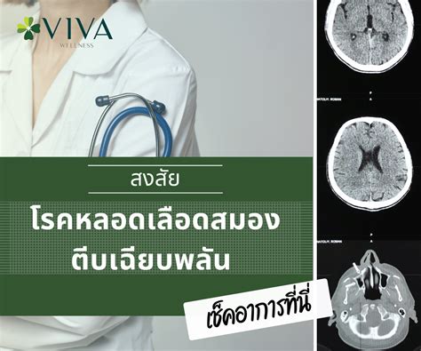 สงสัย เส้นเลือดสมองตีบ เช็คอาการ Viva Wellness