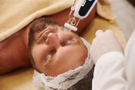 Patchy Beard Treatment Este Medical Group