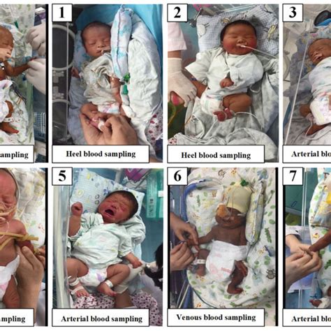 Samples Of Neonatal Pain Data With Different Blood Sampling Operations