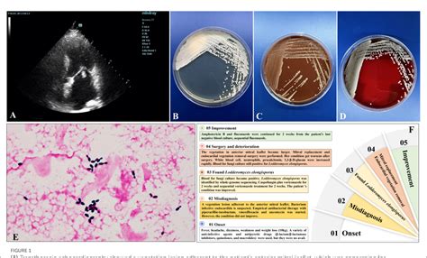 Figure 1 From Subacute Infective Endocarditis Due To Lodderomyces