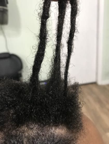 How To Soothe Itchy Scalp Without Damaging Your Roots Artofit