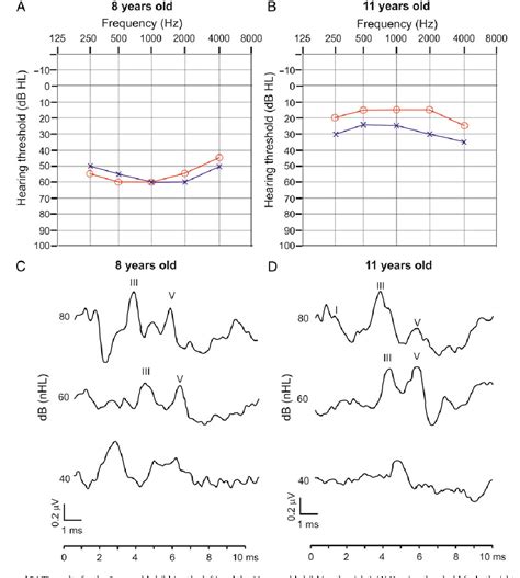 Figure 1 From Evaluating Long Latency Auditory Evoked Potentials In The