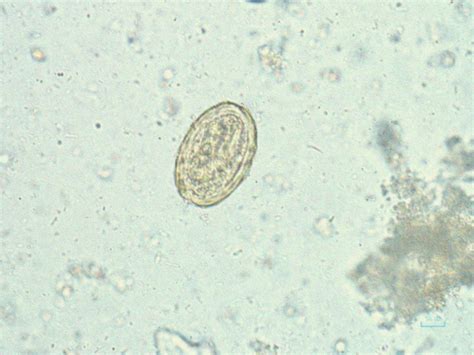 Teste 80 Imagens Usando Bouding Box Object Detection Dataset And Pre Trained Model By Projeto