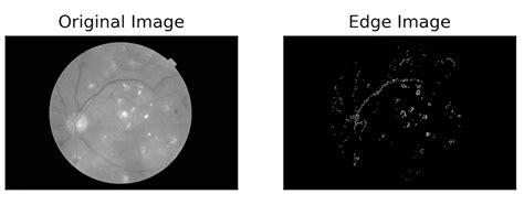 Python Obtain Features Inside Image And Remove Boundary Stack Overflow