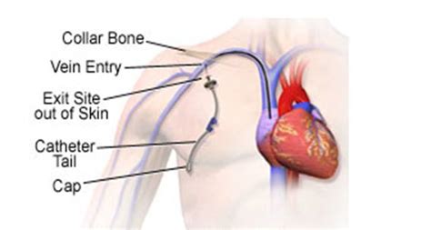 Part 5 Common Icd 10 Coding Errors