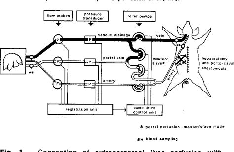 Figure 1 From Extracorporeal Liver Perfusion Applications Of An