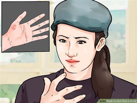 How To Not Pick A Scab Steps With Pictures WikiHow