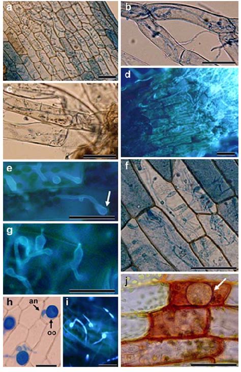 Invasion Of P Patens Tissues By Pythium Irregulare And Pythium