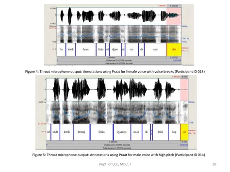 Ppt Piezoelectric Throat Microphone Based Voice Analysis Pptx