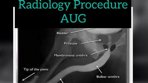 Aug Rug Radiographer Radiology Procedure Ascending Urethrogram