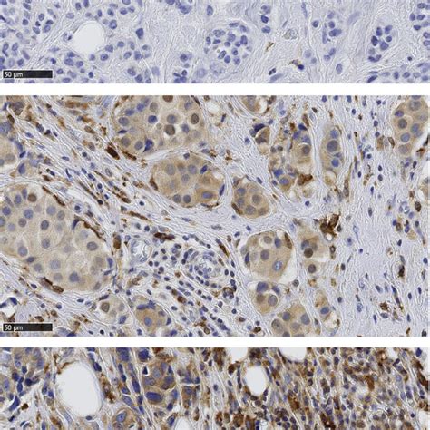 Definition Of Each Subtype In Molecular Classification Download Table