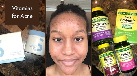 Vitamins For Acne Hormonal Acne Acne Help Clear Skin Care