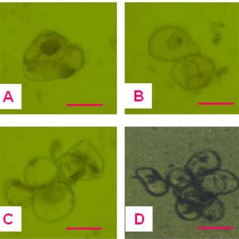 Globular Stage Of Somatic Embryos In Liquid Cell Suspension Culture