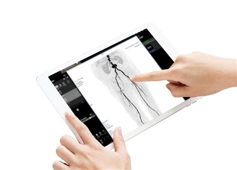 Peripheral Artery Disease Vs Peripheral Vascular Disease