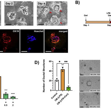 A Primary Pancreatic Acinar Cells From Kc Mice Were Isolated And