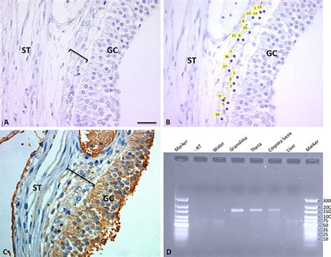 Theca Cells Plos One