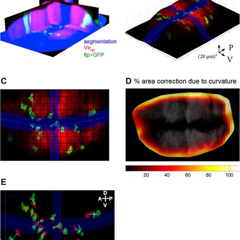 Image Processing For Dynamic Clonal Analysis A Cross Sectional View