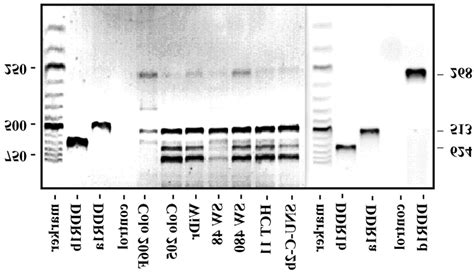 Expression Of Multiple Ddr1 Transcripts In Colon Carcinoma Cell Lines
