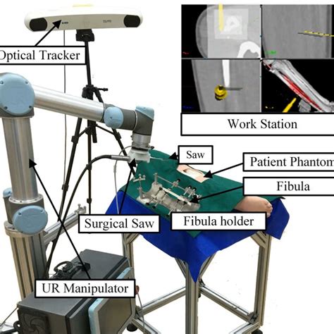 Hardware Of Robot For Fibulectomy In Mandibular Reconstruction