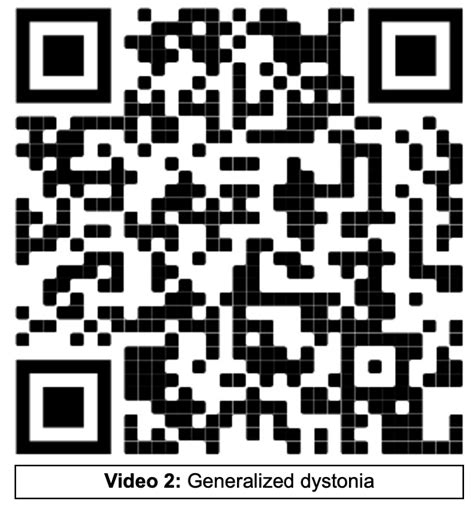 Lentiform Fork Sign And Wilson Disease Mds Abstracts