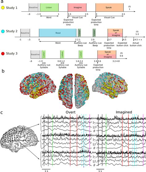 Decoding Imagined And Spoken Speech Using Ecog Insights From Neuroscience — Paper Summary By
