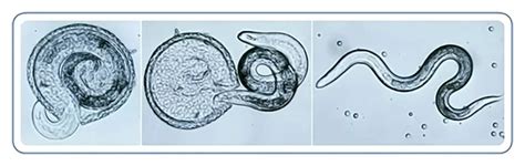 Toxocara Canis Retina